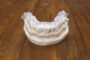 Invisalign Express® | Milnor Orthodontics | Fort Collins, CO
