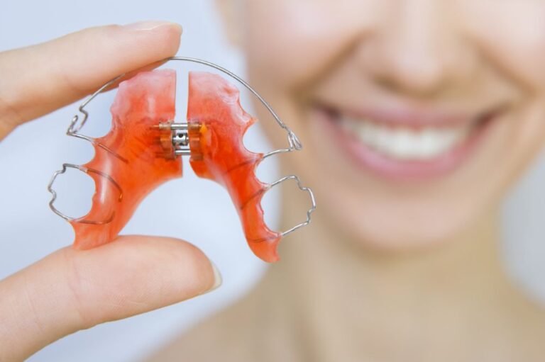 Tips for Taking Care of Retainers | Milnor Orthodontics | Fort Collins